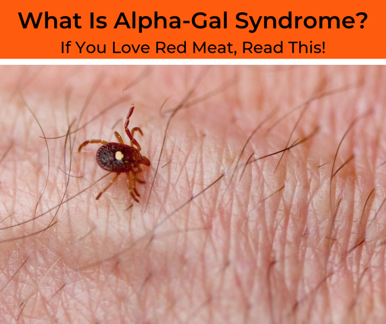 What Is Alpha-Gal Syndrome?